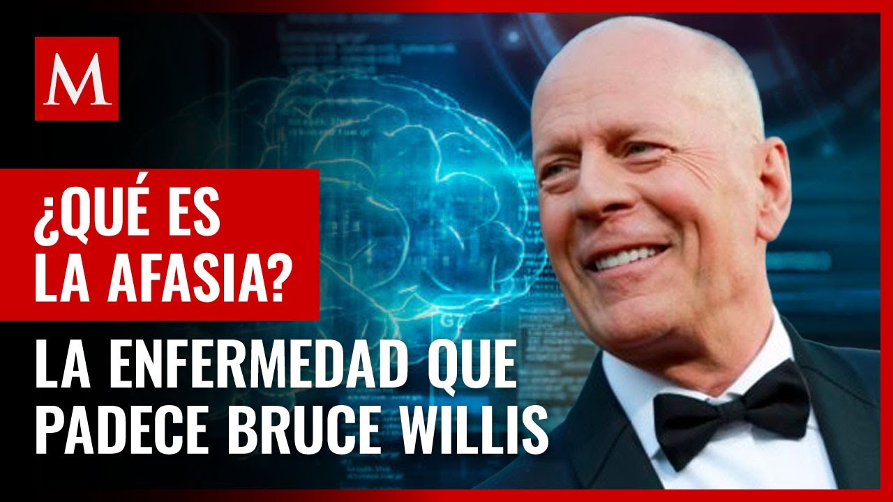 Descubre todo sobre la enfermedad que padece Bruce Willis" - Guía completa sobre la enfermedad ...